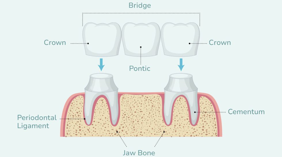 Restorative - The Orthodontic Clinic