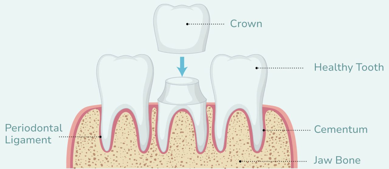 Restorative - The Orthodontic Clinic