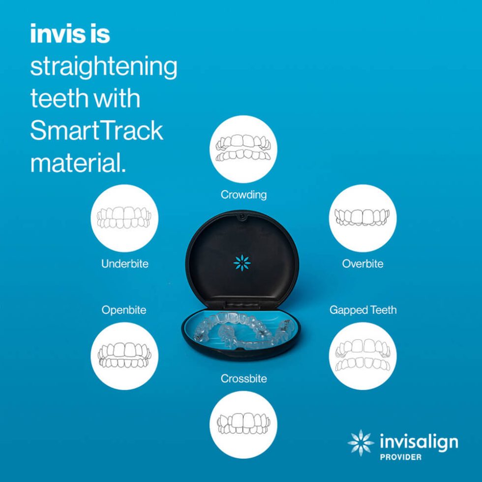 Invisalign And Clear Aligners - The Orthodontic Clinic